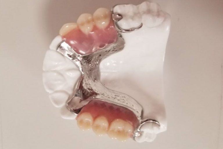 Services – Denture Design Lab